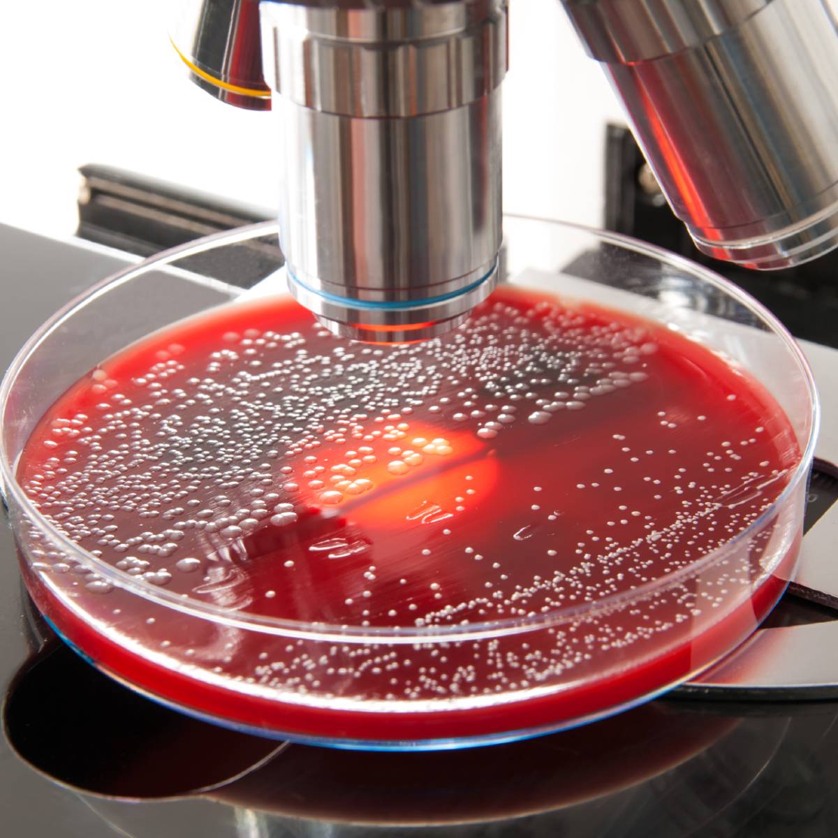 Isolation and Preservation Methods for Pure Culture