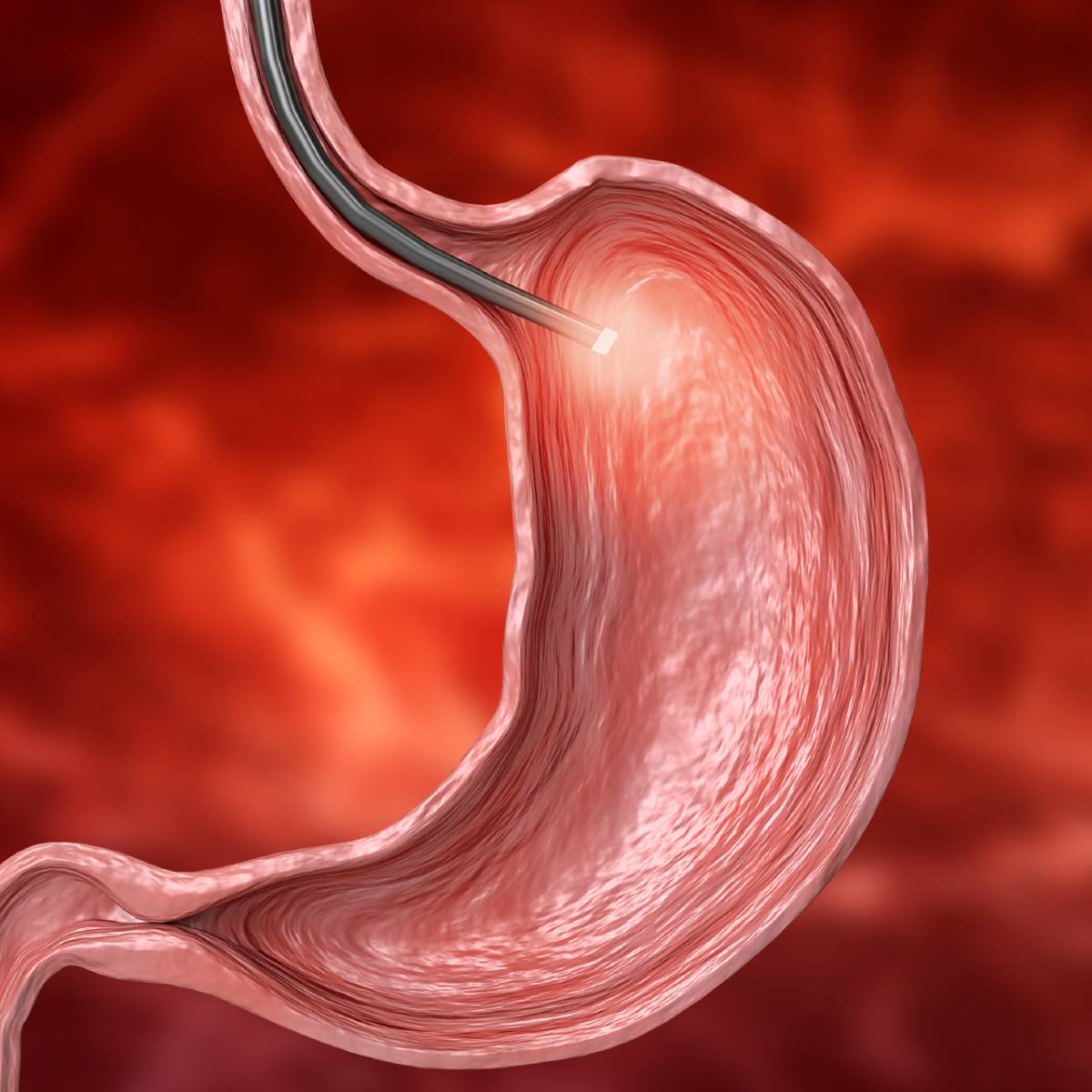 Diagnostic Procedures of Digestive System
