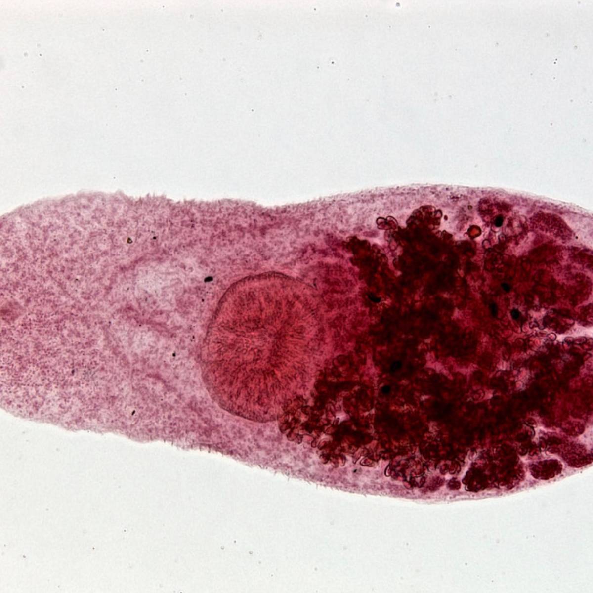 Heterophyes Heterophyes