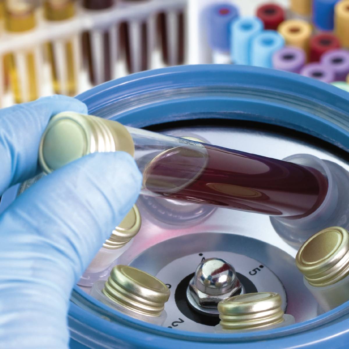 Separation of Serum and Plasma