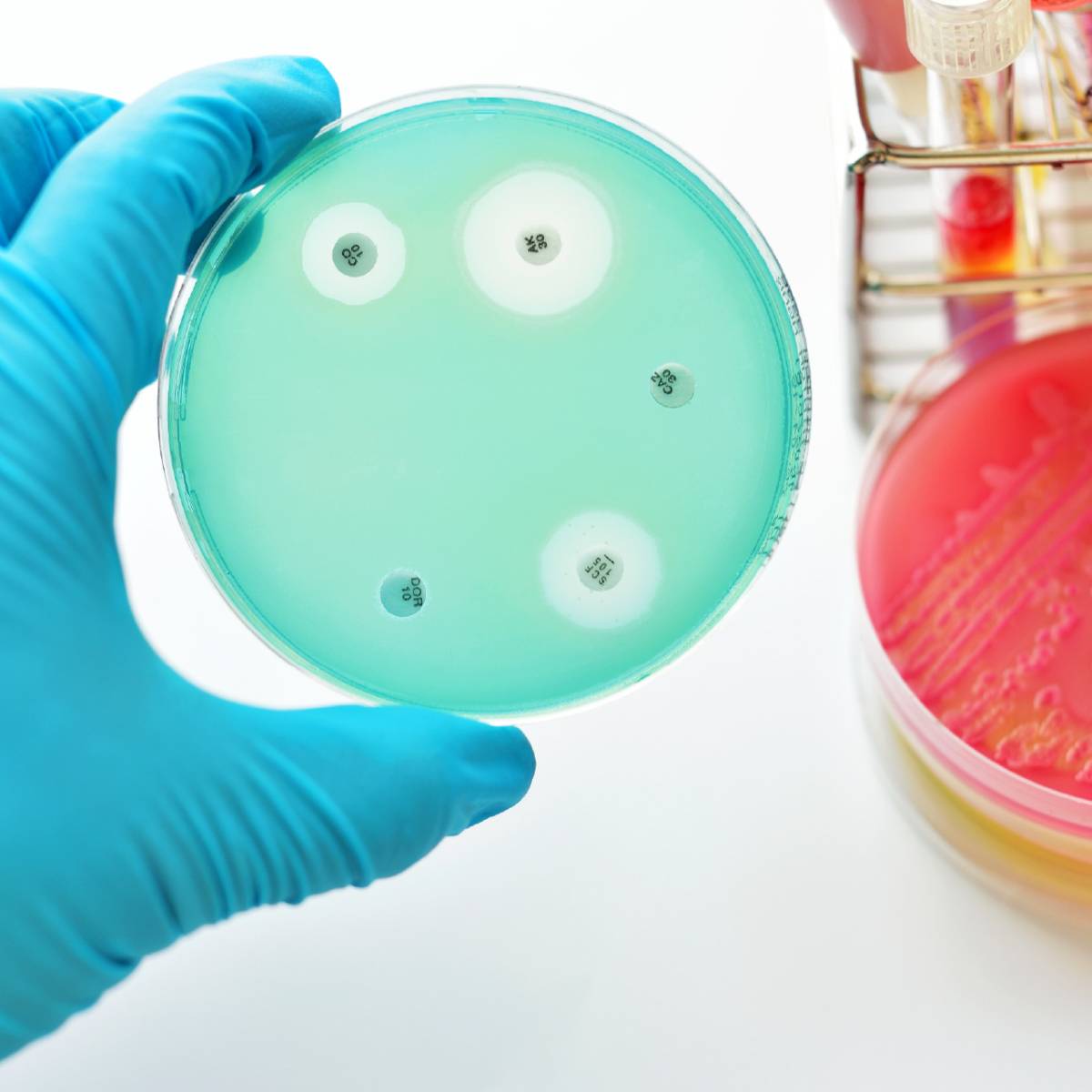Antibiotic Sensitivity Test